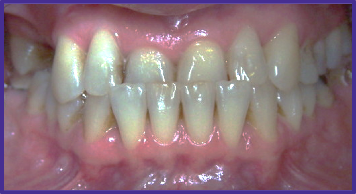 Fastbraces® Charlotte NC, Holistic Dental: Stella O Nnadi DMD PA